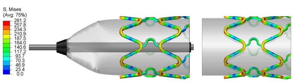 Numerical Modeling of Biodegradable Stent Corrosion | FEA & CFD ...